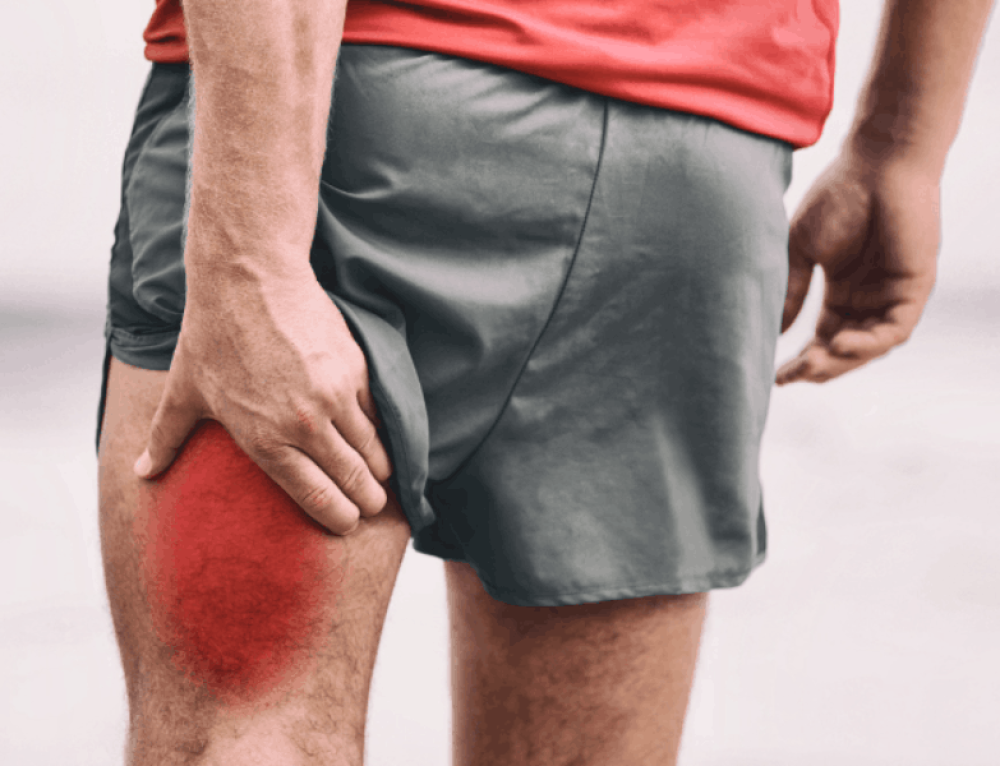 Distensión muscular: qué es, síntomas y tratamiento - FisioB